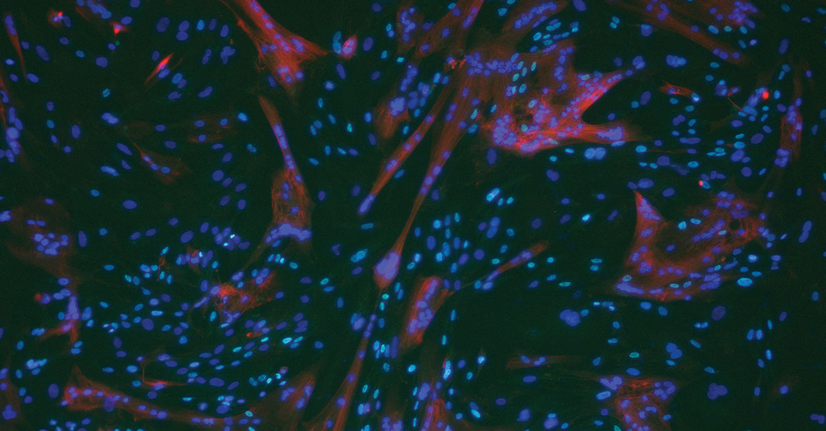 The Cultivated B - Cell line technology and services